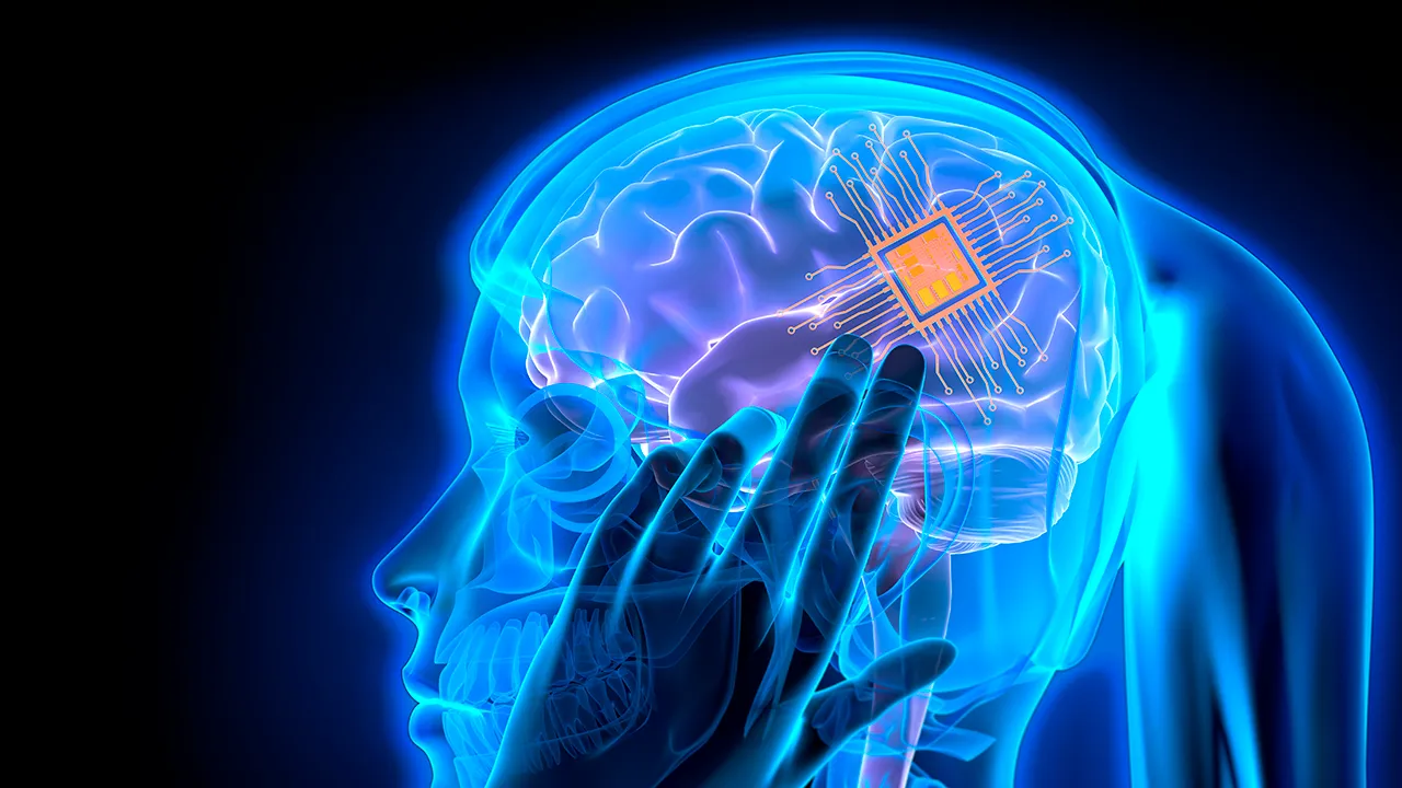 Brain implants, game-changers in humanity's future - sauce.co.ke