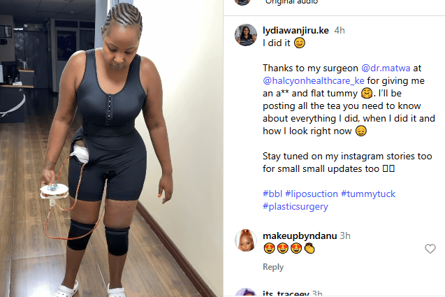 Content Creator Lydia Wanjiru Reveals she Underwent Liposuction ,Tummy ...